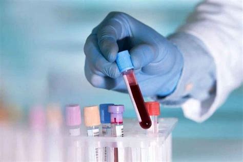 What Is A Normal Hb Count Understanding Hemoglobin Levels And Ranges