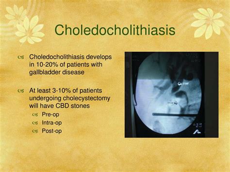 Ppt Cholangitis And Management Of Choledocholithiasis Powerpoint Presentation Id 4488108