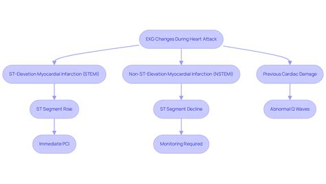 What Does An Ekg Look Like During A Heart Attack