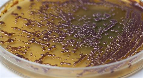 Bacterial Culture On Agar Plate Colony Growth Stock Illustration