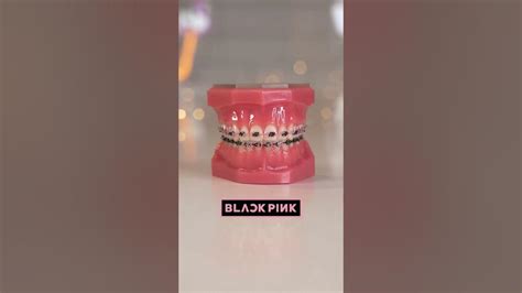 K Pop Groups Braces Colors Bts Braces Blackpink Braces Twice