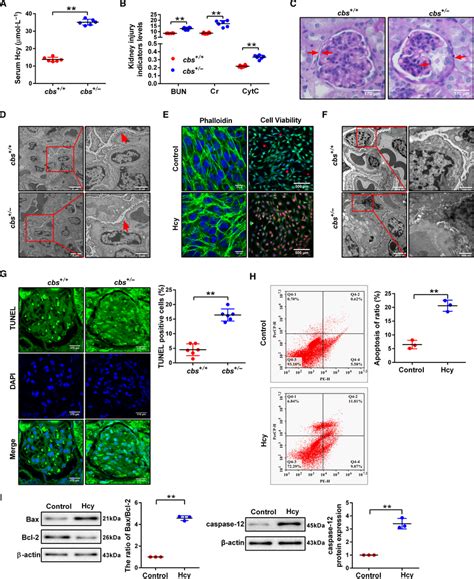 Hcy‐induced Podocyte Apoptosis And Glomerular Injury Ab The Levels