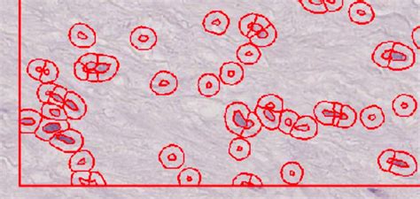 fragmentation and incorrect nuclei detection on stardist image