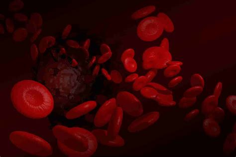 Sickle Cell Anemia Sickle Cell Anemia Eradication Mission Study Budys