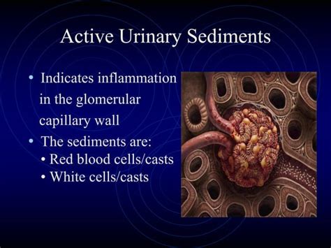 Approach To A Patient With Active Urinary Sediments Pptx