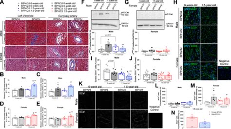 Hypertensive Bph2j Mice Exhibit Sex Specific Heart Failure Progression