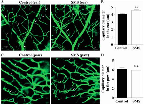 Capillary Dilation Is Observed In Auricles Of The Sms Group At 30 Min