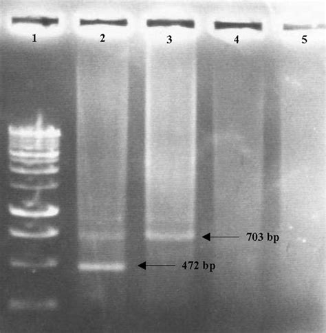 Different Conditions Observed In The Nested Pcr Eia Analysis Of Cp Download Scientific Diagram