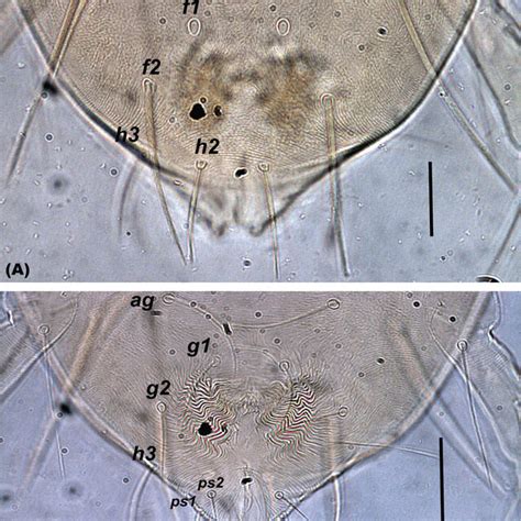 Shape Of Setae H2 And H3 Are Similar To Other Ventral Body Setae In All