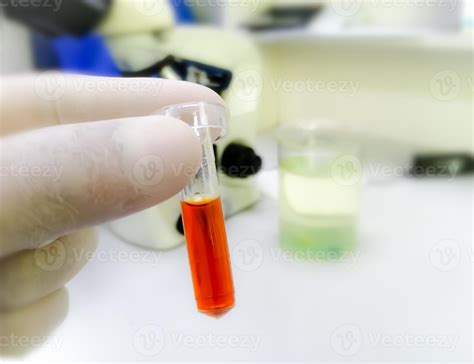 Scientist Hold Sample Cup With Icteric Serum For Test In Laboratory