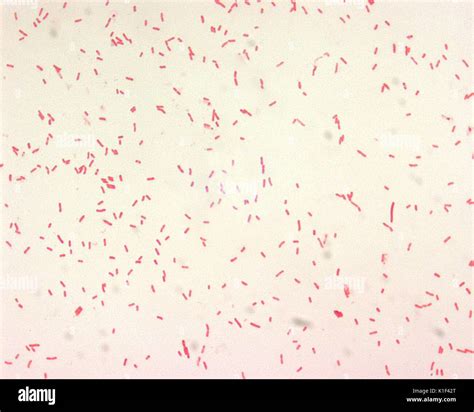 Yersinia Pestis Gram Negative Bacillus Y Pestis Is A Small 05 X 1