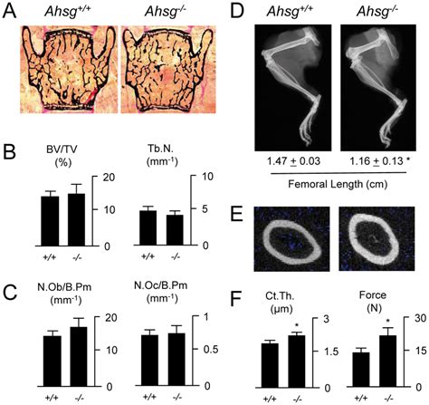 Normal Trabecular Bone Mass But Increased Cortical Bone Strength In