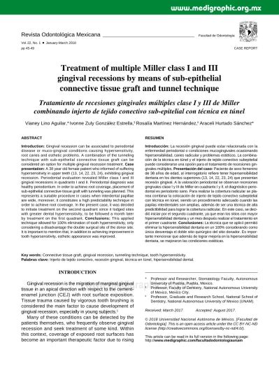 Treatment Of Multiple Miller Class I And Iii Gingival Recessions By Means Of Sub Epithelial