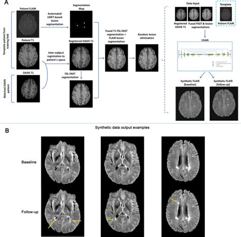Addressing The Generalizability Of Ai In Radiology Using A Novel Data Augmentation Framework