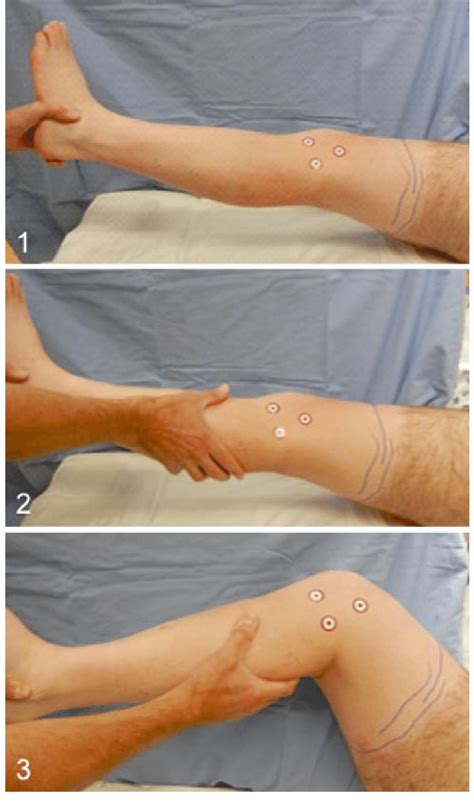 Lateral Pivot Shift Test Knee