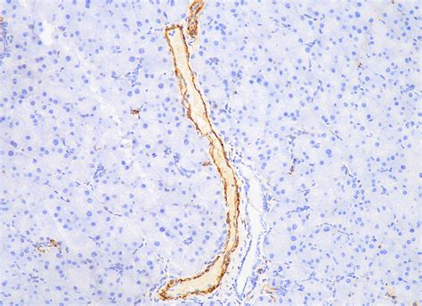 博士德生物 Boster Biological Technology Coltd 1993 2025
