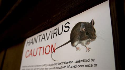 Hantavirus News Todays Latest Updates Cbs News