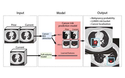 Steps In A Deep Learning Model Of Lung Nodule Detection At Carolyn Wilson Blog