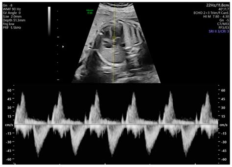 Diagnostics Free Full Text Evaluation Of The Fetal Left Ventricular