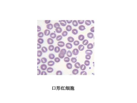 血液细胞图谱word文档在线阅读与下载无忧文档