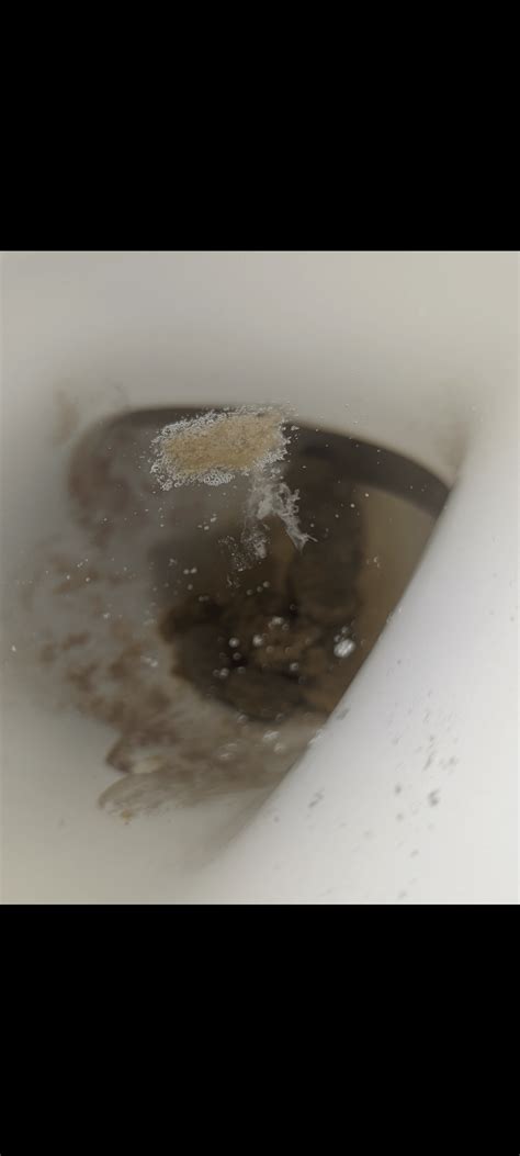 Nsfw Candida Overgrowth In Stool Rcandida