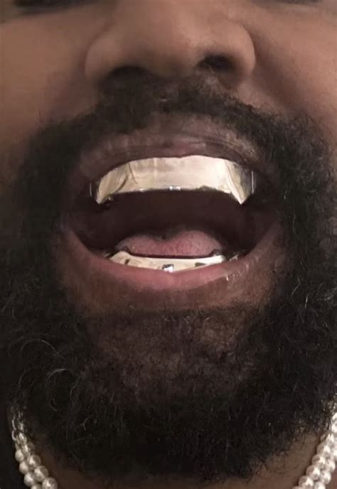 Kanye West Debuts Us850k Titanium Teeth Reportedly Inspired By A