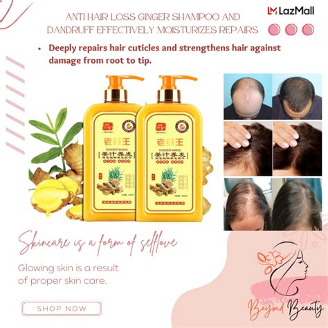Best Selling Ginger Wang King Of Ginger Anti Hair Loss Ginger Shampoo And Dandruff Effectively