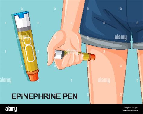 Illustration Of An Epinephrine Pen In Hand Stock Vector Image And Art Alamy