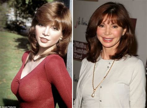 Did Victoria Principal Get Plastic Surgery Facelift Botox Injections