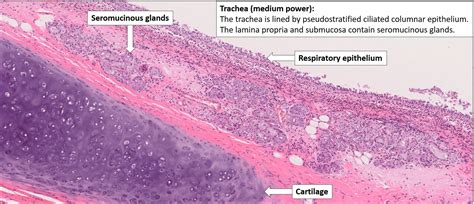 File Trachea Mammal Histology Wikipedia 58 Off
