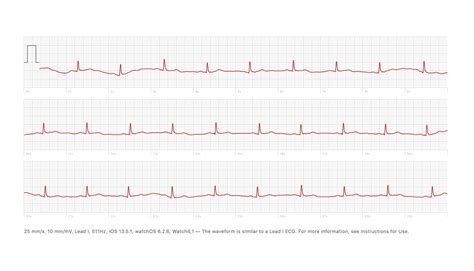 Classification With High Interpretability Hybrid Thinking Doing By