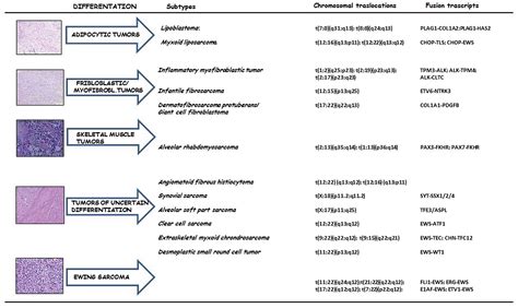 Soft Tissue Neoplasms
