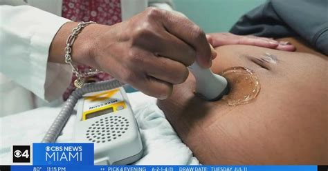 Cdc Black Women More Likely To Die From Pregnancy Related Issues Cbs