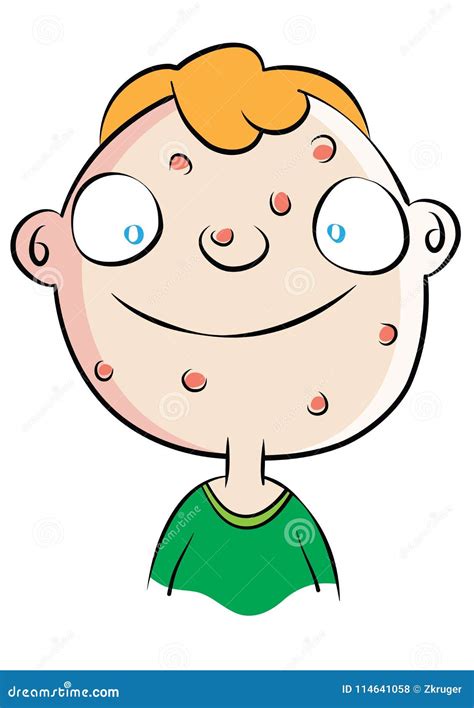 Funny Pimple Cartoon
