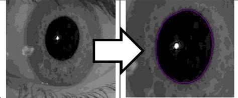 Outcome Example Of The Image Thresholding And The Pupil Region Download Scientific Diagram
