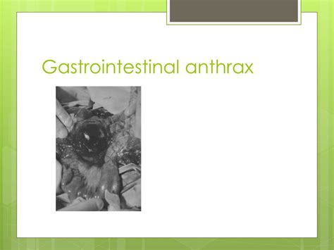 Ppt Anthrax Powerpoint Presentation Free Download Id2863629
