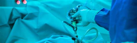 Sigmoid Diverticulitis Mysurgery