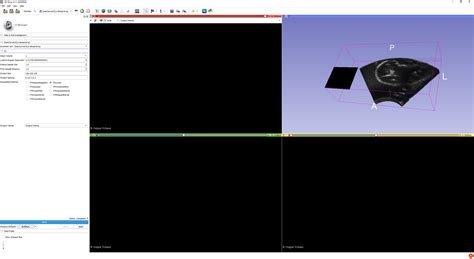 How To Interpolate Between Slices Using Gaussian Kernel Sliceritkultrasound Module Support