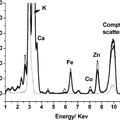 The Compton Scattering Radiation Image Of Brain Section Of Alzheimers
