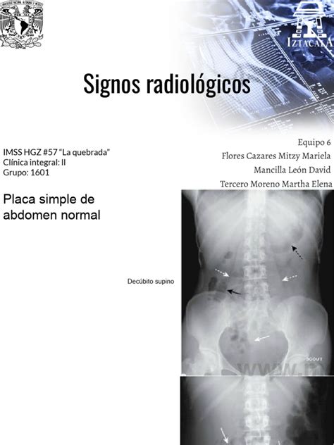 Signos Radiológicos Pdf