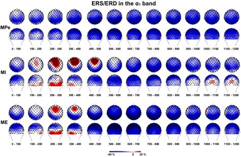 Topographies Of Event Related Synchronization Ers Red And