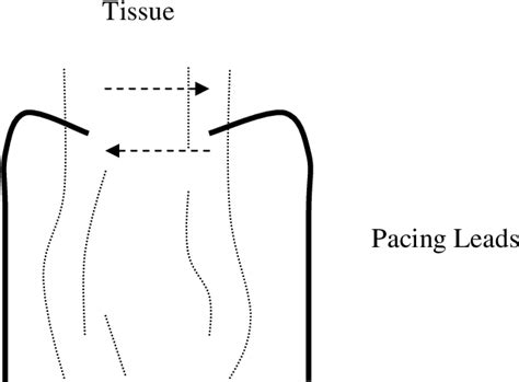 Figure 17 From Design And Construction Of A Left Ventricular
