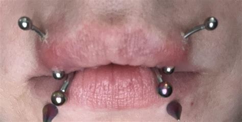 Angel Fangs R Piercingadvice