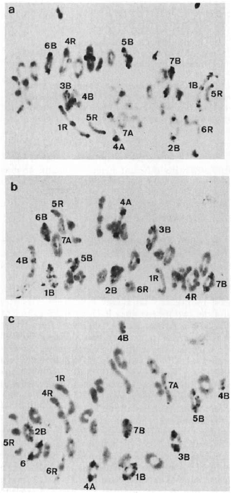 Photomicrographs Of Pmcs At First Metaphase Of The Three Octoploid