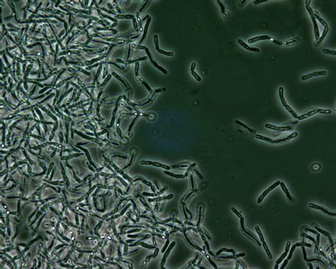 Free Picture Bacillus Anthracis Endospores Phase Contrast Microscopy Lighter Areas