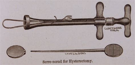 H Abdominal — The Tizzano Museum