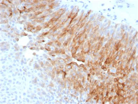 Recombinant Uroplakin 1a Urothelial Differentiation Marker Antibody