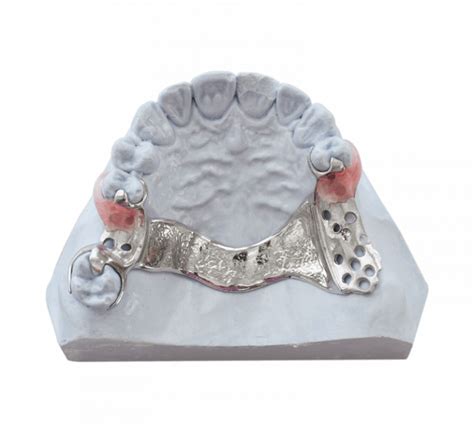 Digital Partial Denture Design Acetal Resin Wironium And Titanium
