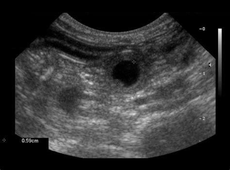 Abdomen Early Pregnancy Ultrasound In Cats Felis Vetlexicon