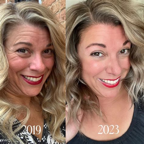 Sonja Schoonenberg On Linkedin Antiaging Holisticantiaging